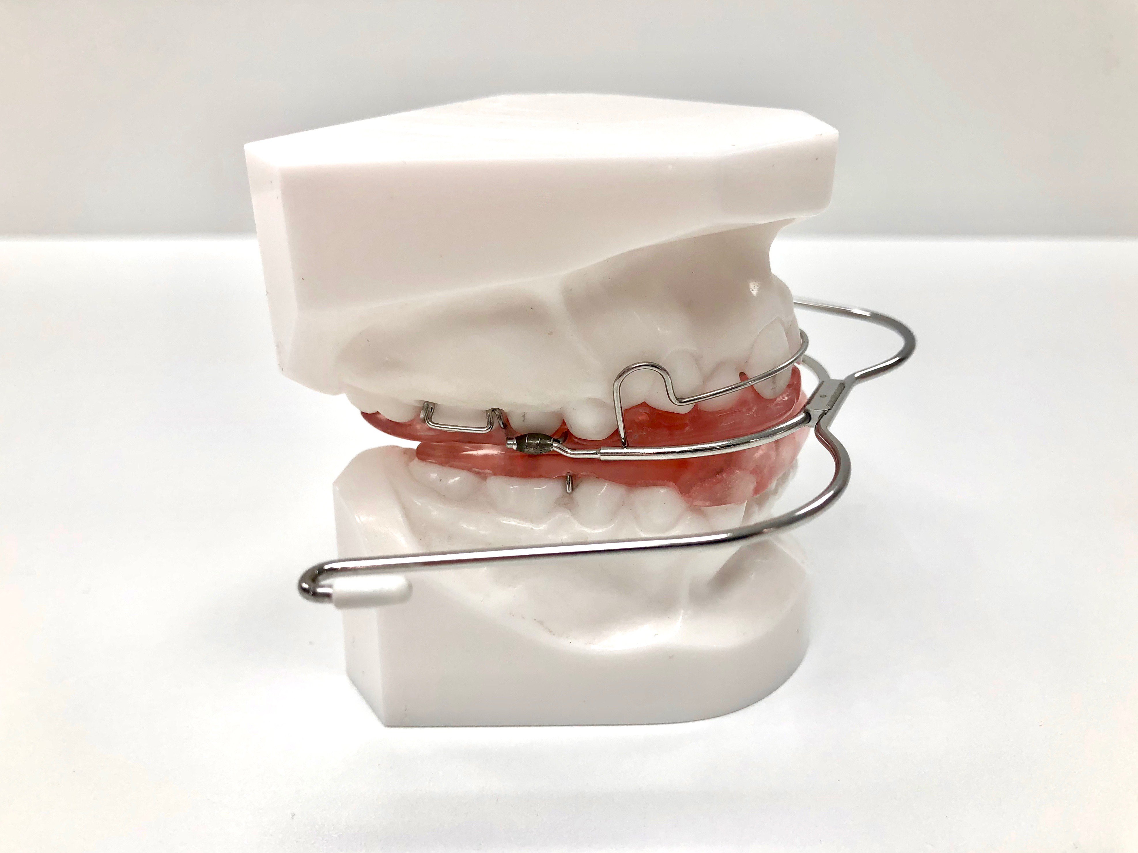 De blokbeugel met buitenboordbeugel en petje (beugelcategorie 3 ...