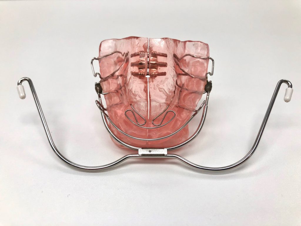 De blokbeugel met buitenboordbeugel en petje (beugelcategorie 3 ...